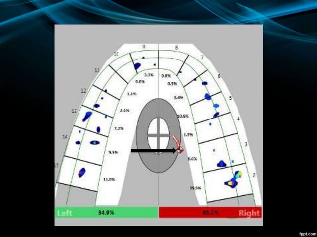 T scan and its application in orthodontics | PPTX