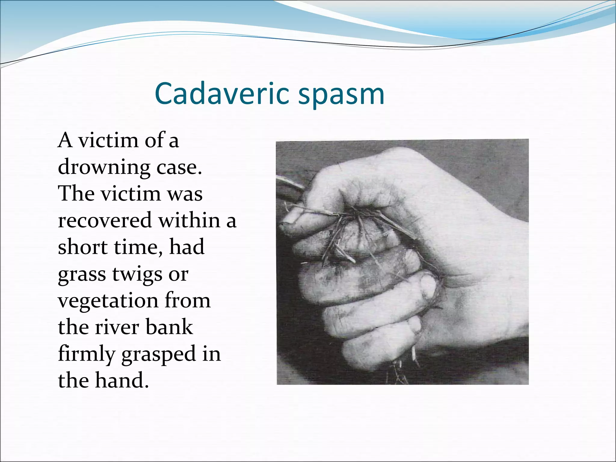 Estimation of Time since death | PPT