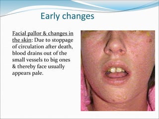 Estimation of Time since death | PPT