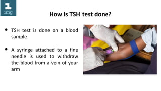 Thyroid Stimulating Hormone Test | ODP