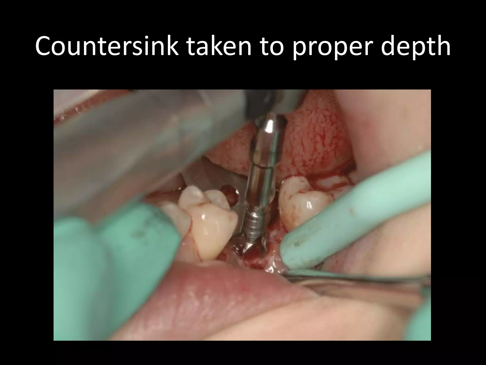 OCO Biomedical TSI Case | PPTX