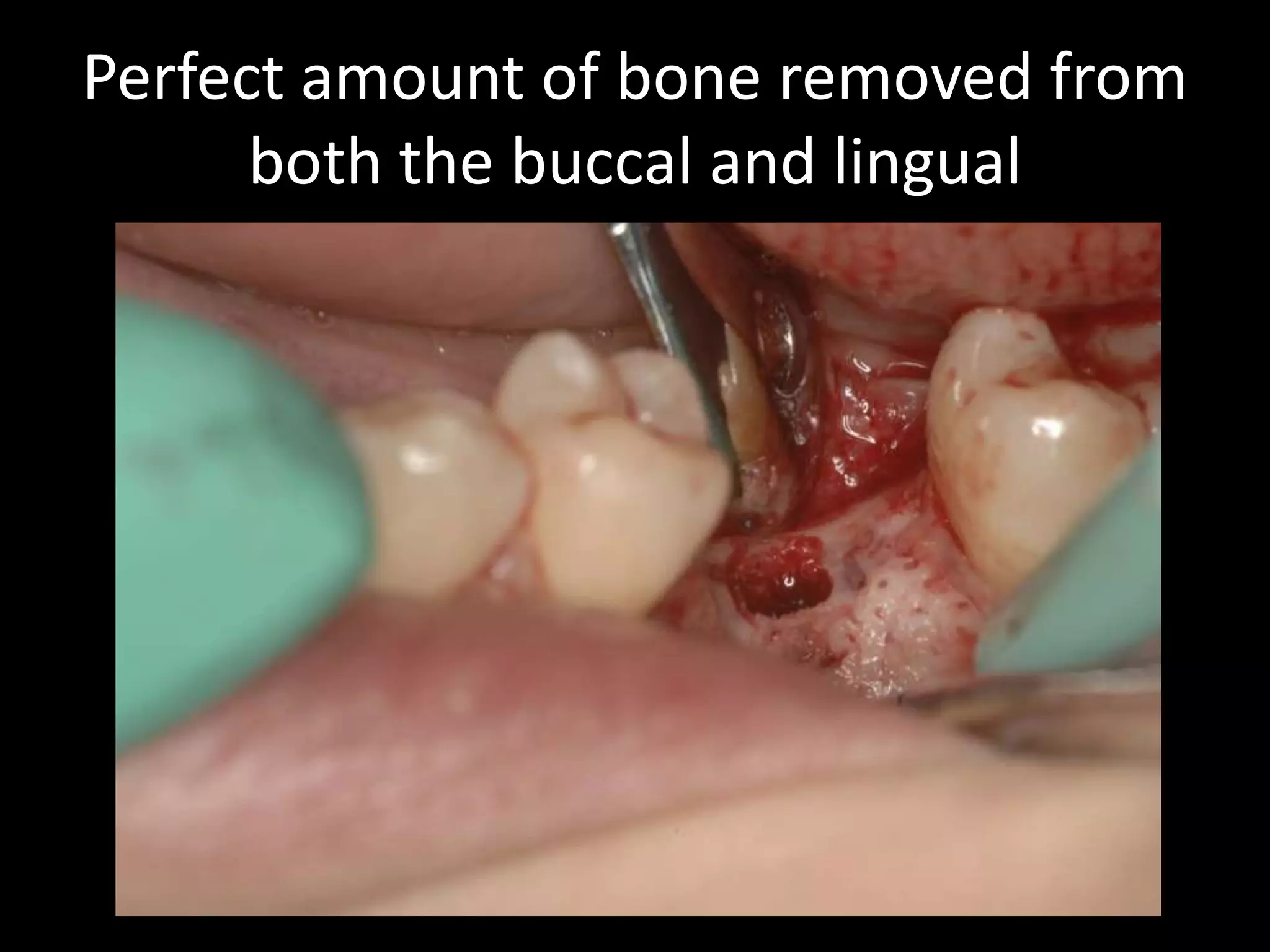 OCO Biomedical TSI Case | PPTX