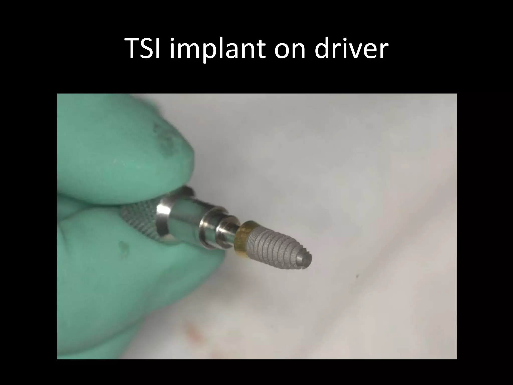 OCO Biomedical TSI Case | PPTX