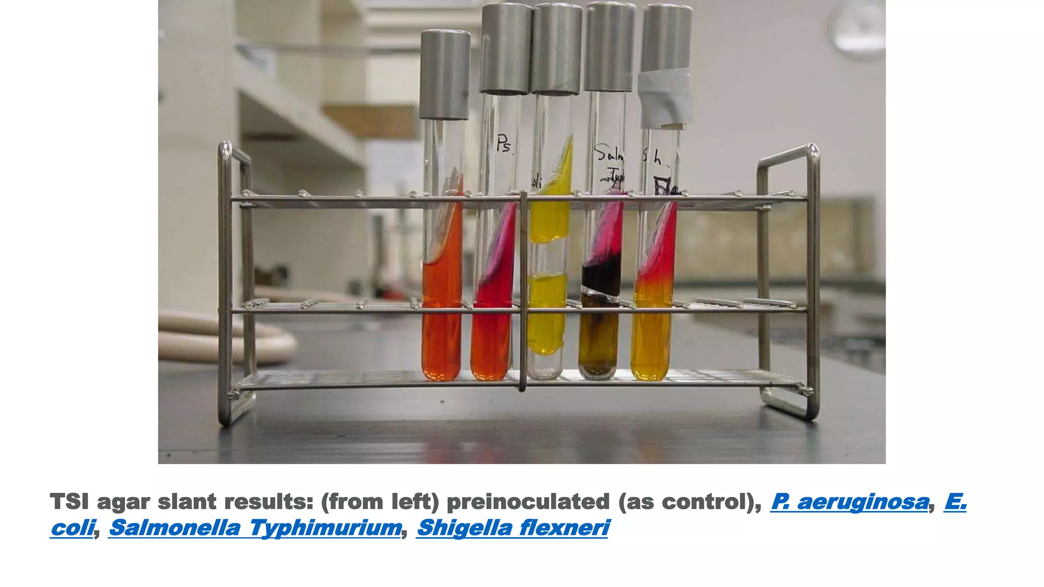 Tsi media & it's interpretation | PDF