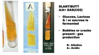 Tsi media & it's interpretation | PDF