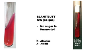 Tsi media & it's interpretation | PDF