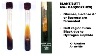 Tsi media & it's interpretation | PDF