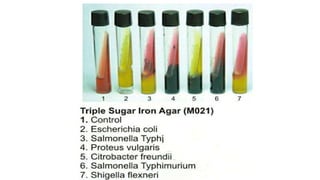 Tsi media & it's interpretation | PDF