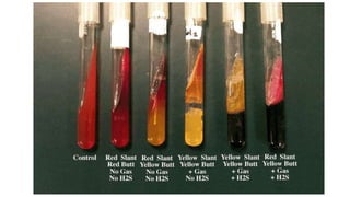 Tsi media & it's interpretation | PDF