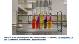 Tsi media & it's interpretation | PDF