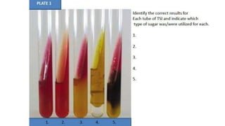 Tsi media & it's interpretation | PDF