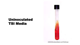 Tsi media & it's interpretation | PDF