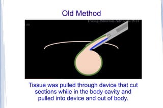 Ex cite safer-tissue-extraction-explained | PPT