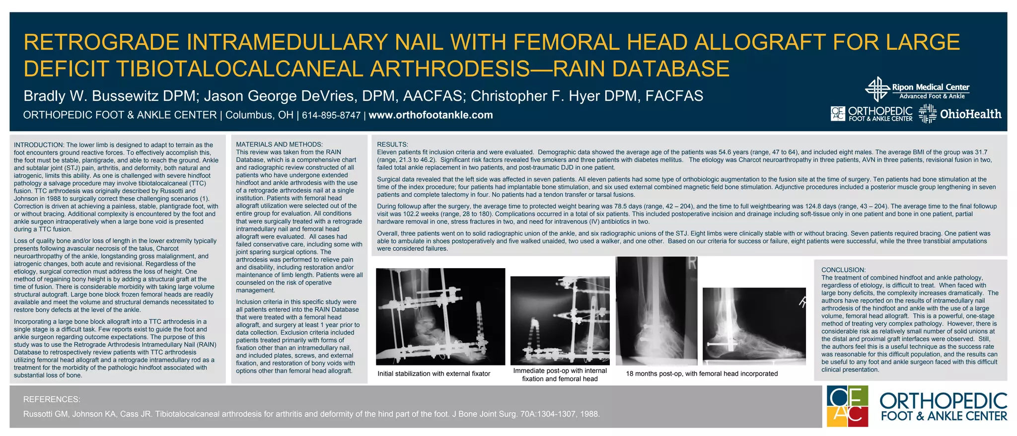 Retrograde Intramedullary Nail with Femoral Head Allograft for Large ...