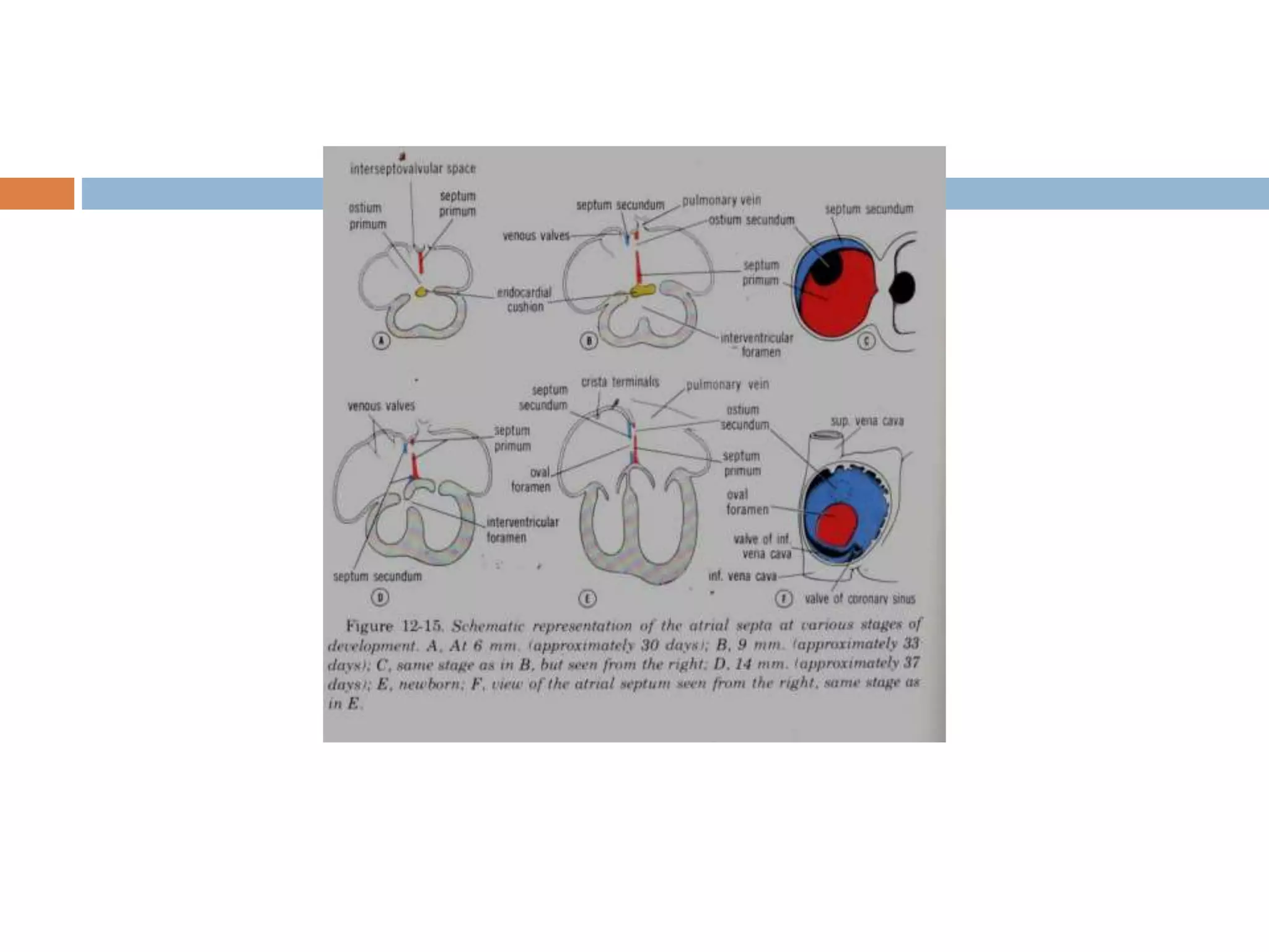 Tte and tee assessment for asd closure 2 | PPTX