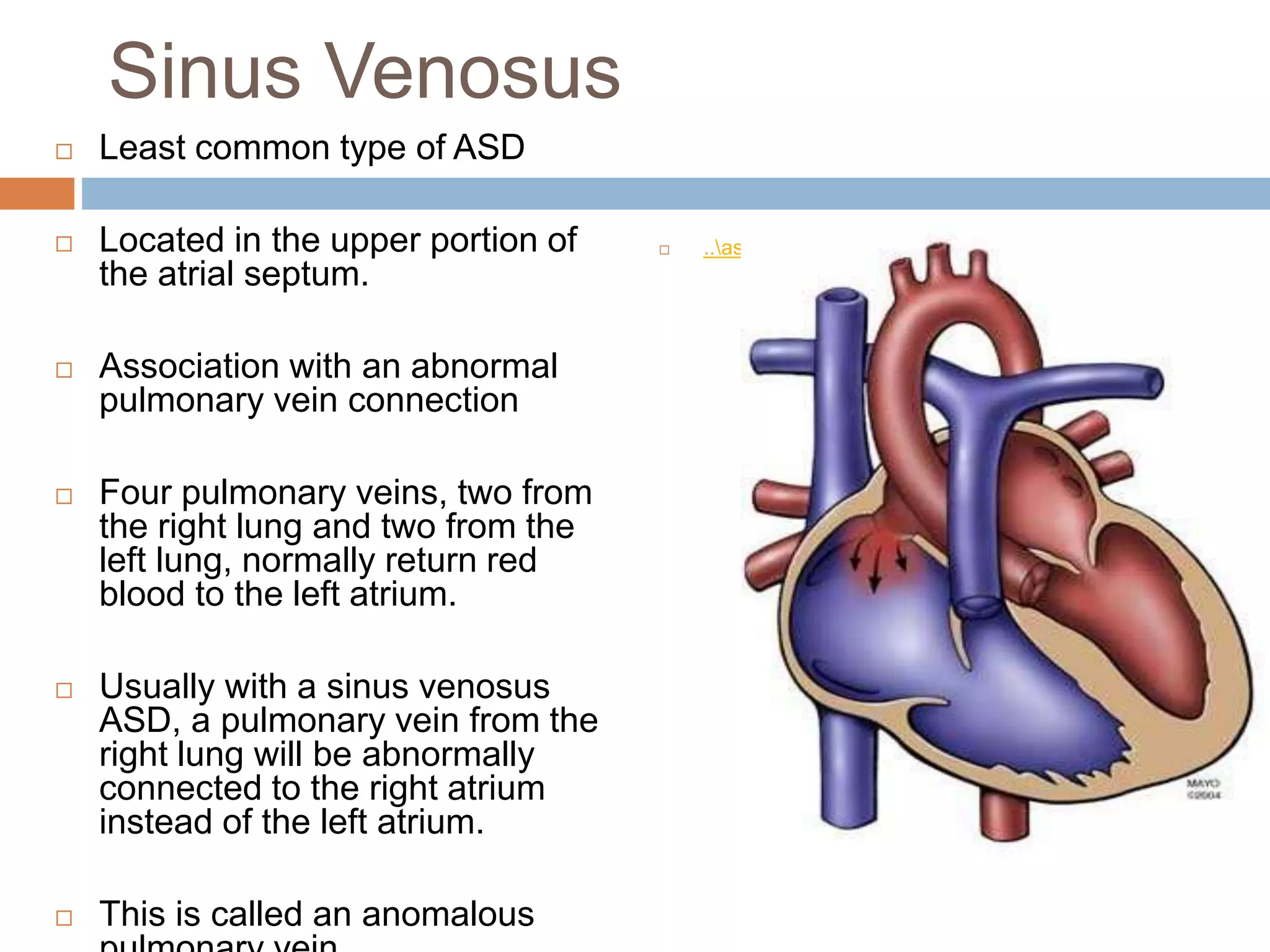 Tte and tee assessment for asd closure 2 | PPTX