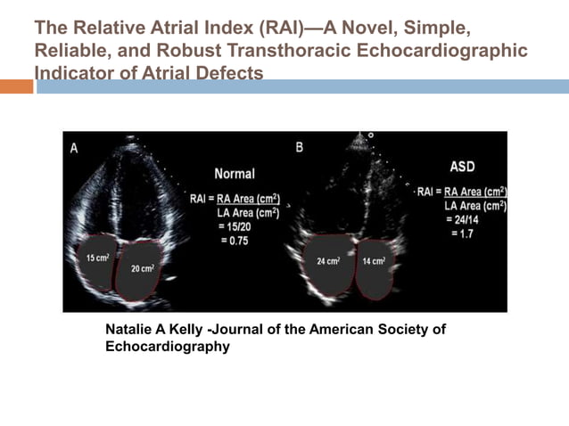 Tte and tee assessment for asd closure 2 | PPTX | Heart and ...