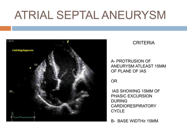 Tte and tee assessment for asd closure 2 | PPTX | Heart and ...