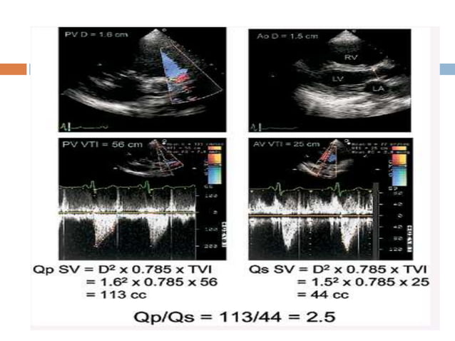 Tte and tee assessment for asd closure 2 | PPTX | Heart and ...