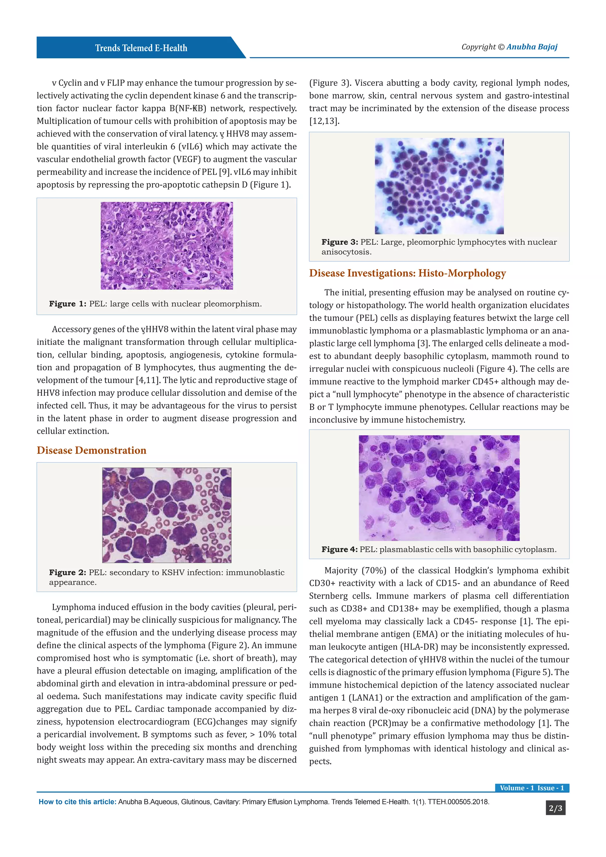 Aqueous, Glutinous, Cavitary: Primary Effusion Lymphoma | PDF