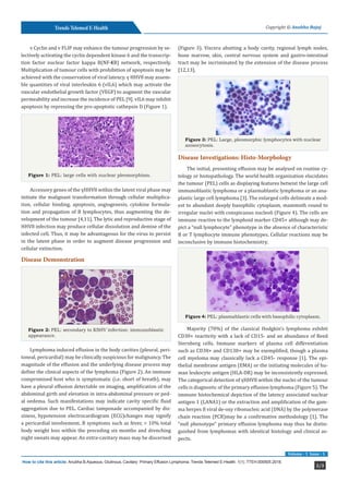 Aqueous, Glutinous, Cavitary: Primary Effusion Lymphoma | PDF