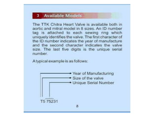 TTK CHITRA VALVE A REVIEW | PPTX