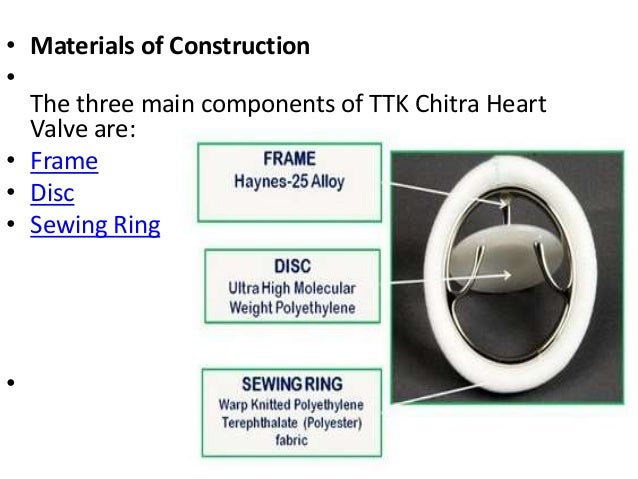 TTK CHITRA VALVE A REVIEW