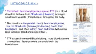 Thrombotic thrombocytopenia purpura .pptx