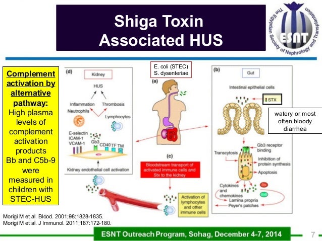 Hemolytic Uremic Syndrome Pathophysiology