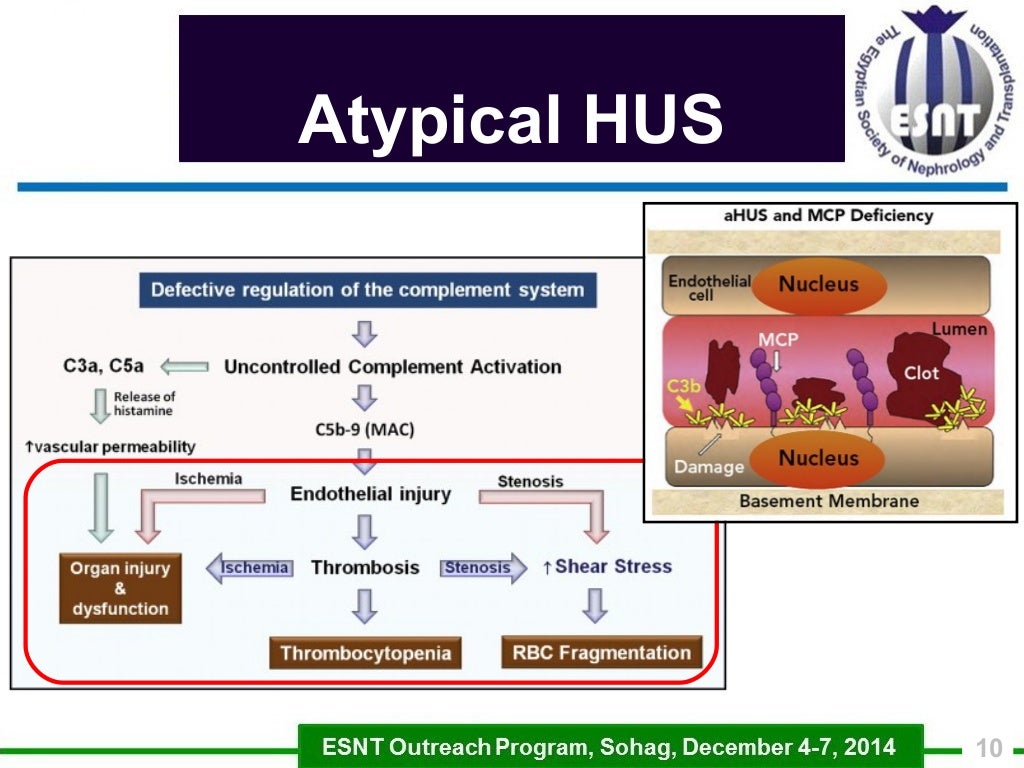 Thrombotic Thrombocytopenic Purpura / Hemolytic Uremic Syndrome (Ques…