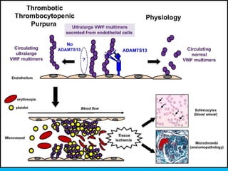 Thrombotic Thrombocytopenic Purpura Smear