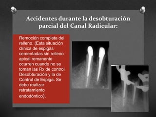 Clase_UPV_Anatomia_dentaria_y_Protesis_Fija.ppt