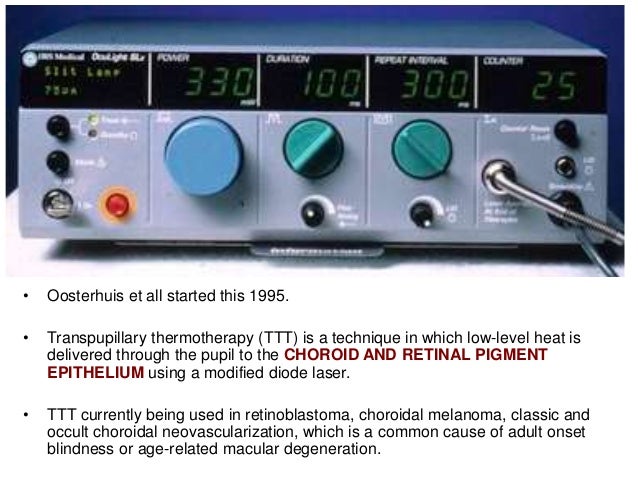 Transpupillary Thermotherapy (TTT)