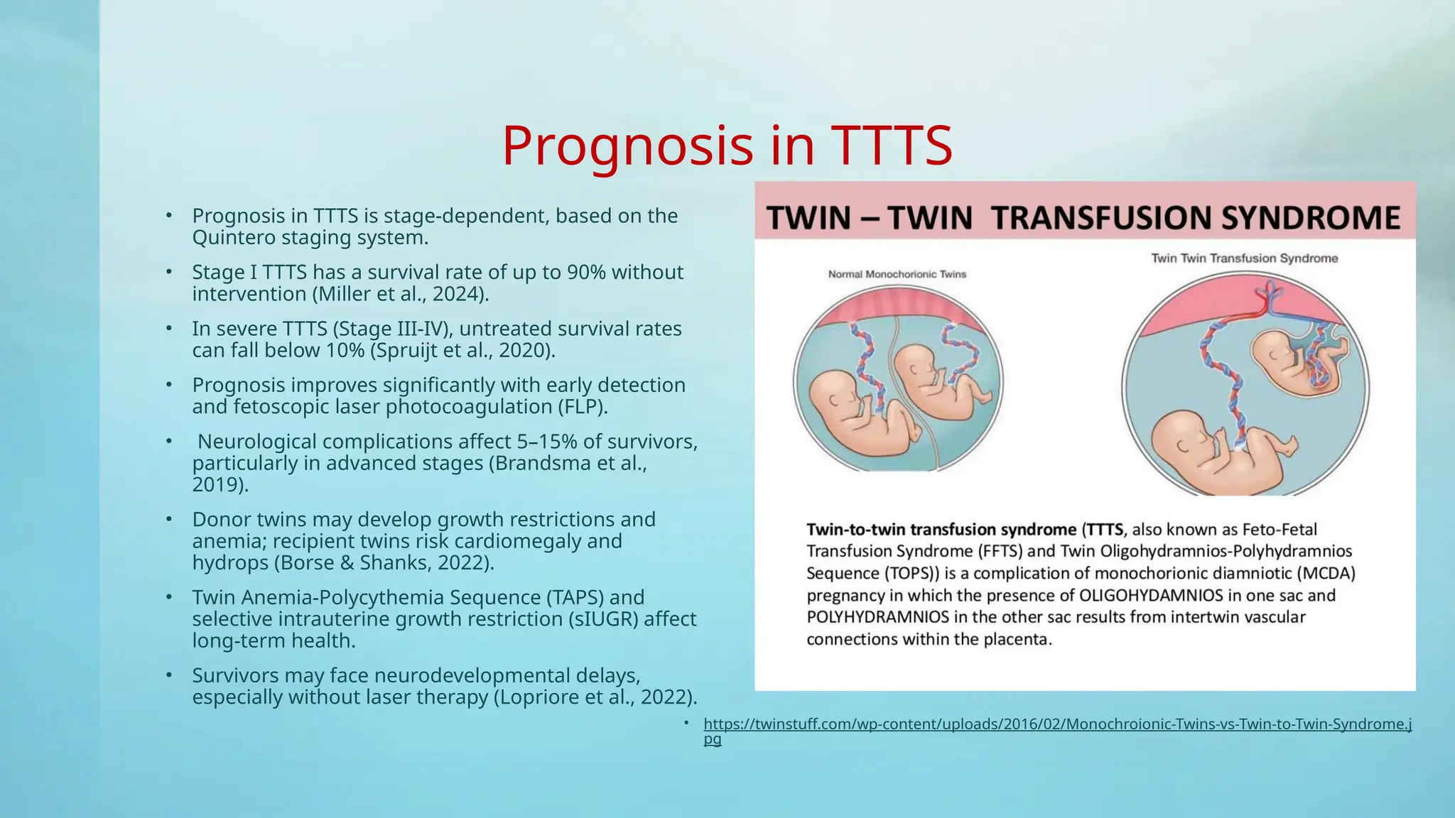 Prognosis in a twin transfusion syndrome. | PPTX