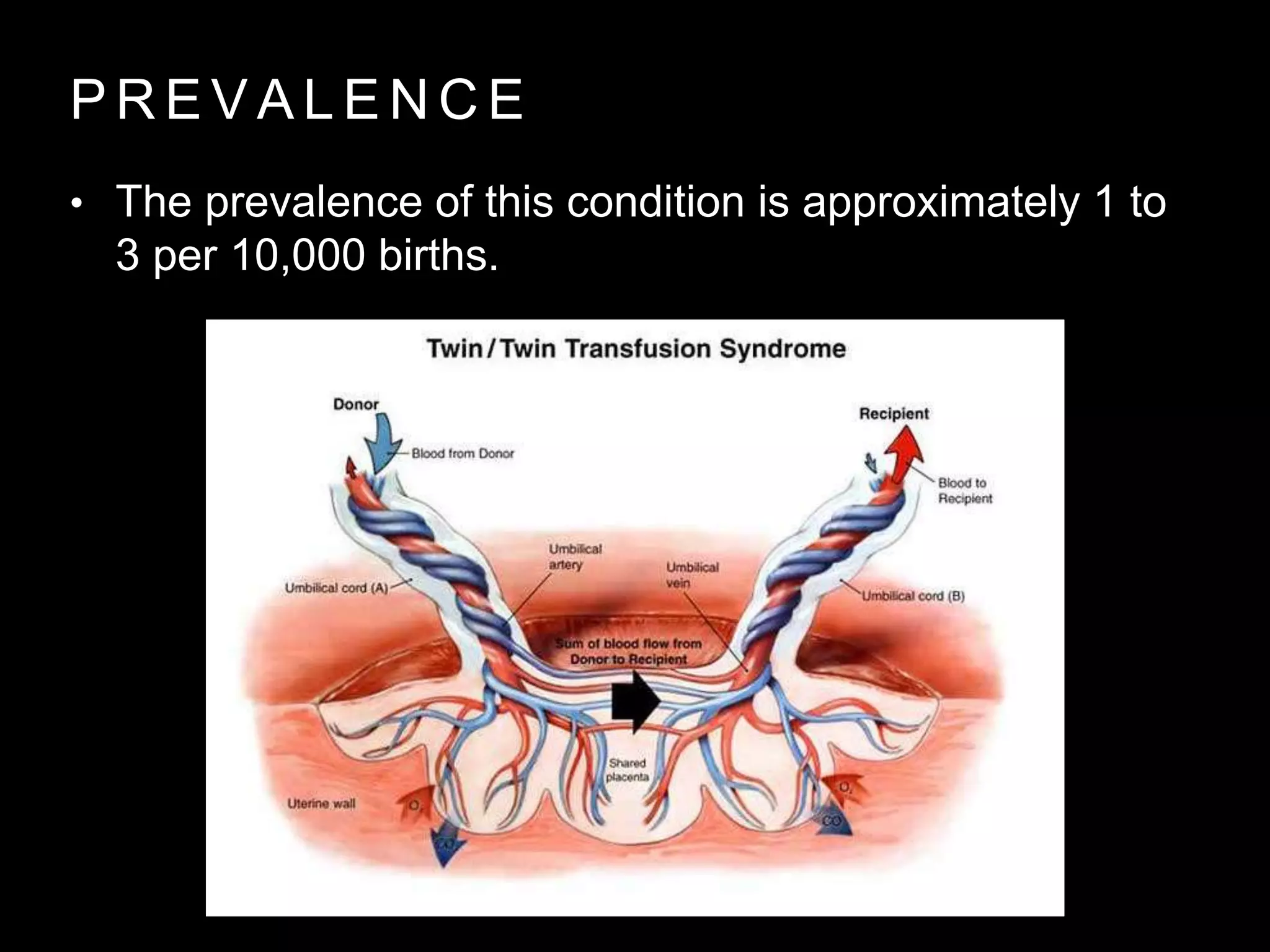 Twin to twin transfusion syndrome | PPTX