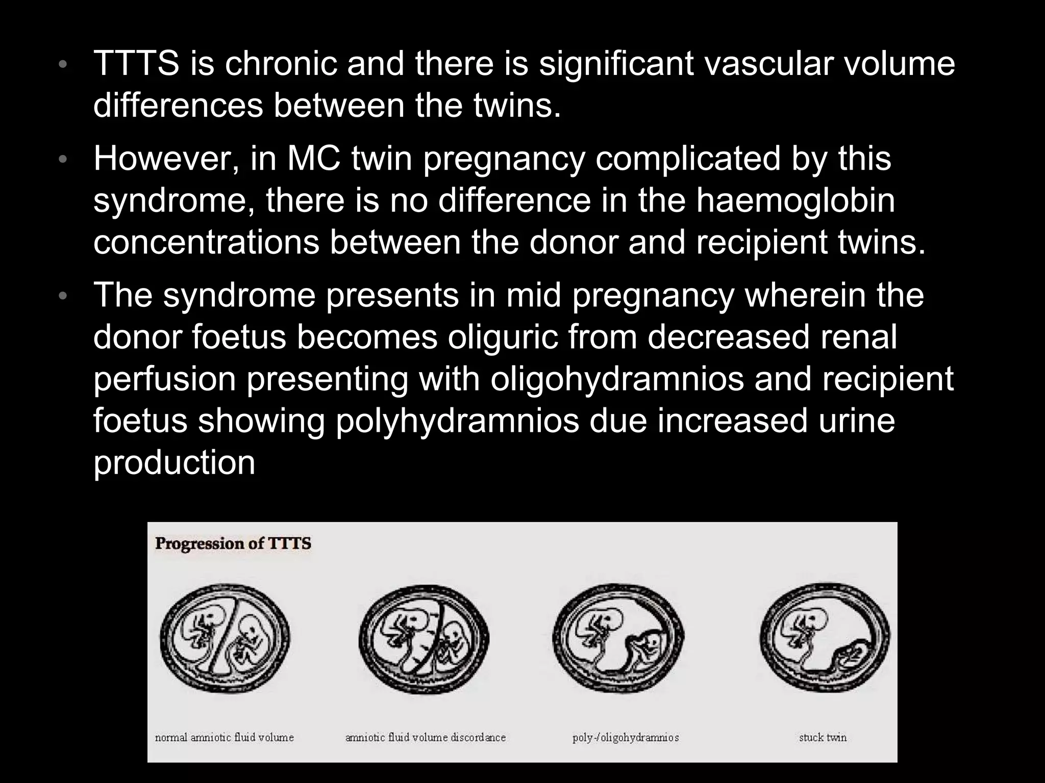 Twin to twin transfusion syndrome | PPTX