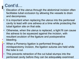 Tubal Sterilization for midwifery students(1).pptx