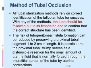 Tubal Sterilization for midwifery students(1).pptx