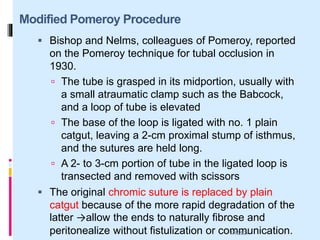 Tubal Sterilization for midwifery students(1).pptx