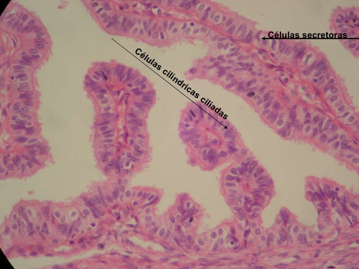 Tubas Uterinas Histologia at Tami Smith blog