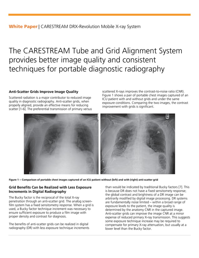 Tube and Grid Alignment System | PDF