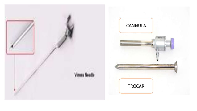 Tubectomy, Non Scalpel Vasectomy ( sterilization) | PPT