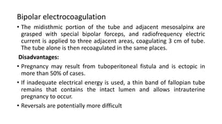Tubectomy, Non Scalpel Vasectomy ( sterilization) | PPT