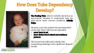 Tube dependency explained in 5 steps