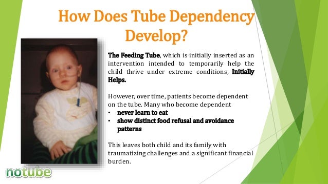 Tube dependency explained in 5 steps