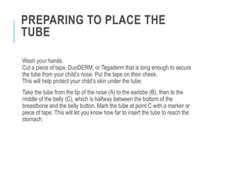 tube fedding.pptx