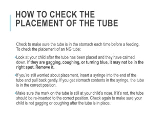 tube fedding.pptx