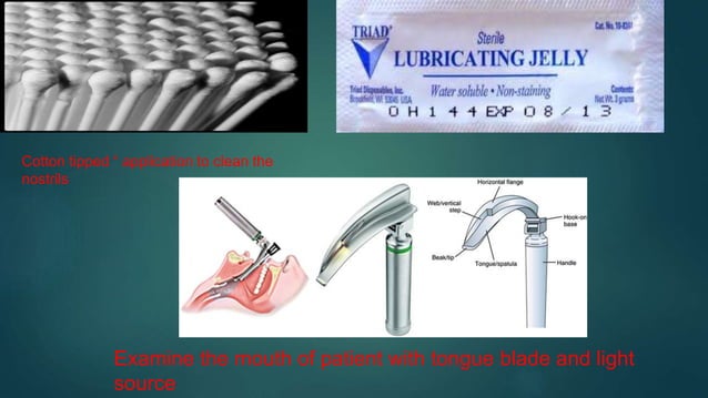Tube feeding ( Gavage feeding ) | PPTX