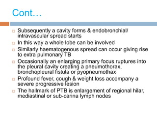 TUBERCLOSIS IN CHILDREN.pptx