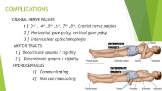Tubercular meningitis - Etiopathogenesis, Clinical features, Advances ...